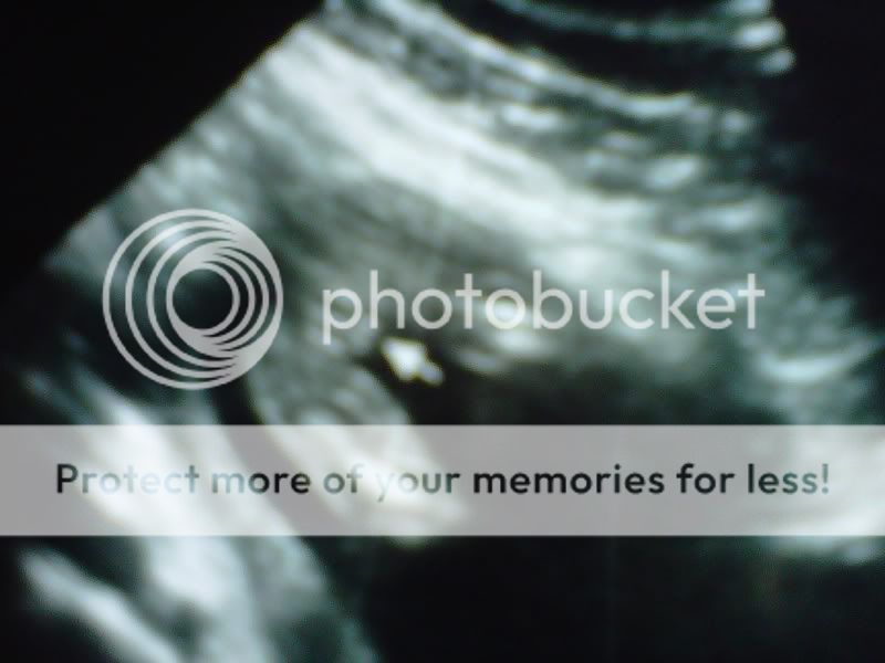 New to Group- Ambiguous Genitalia - BabyCenter